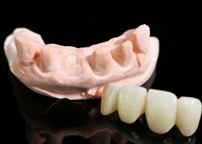 China Access control enabled Ceramic Dental Prosthetics indicating forbidden access ensuring secure and dental restoration processes for sale