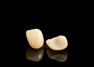China Natural Looking Emax Dental Veneer Durable Long Lasting Esthetic Solution for Dental Clinics and Laboratories for sale