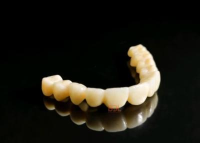 China Durable Ceramic Dental Prosthetics Custom Fabricated Precision Engineered Solutions for Dental Laboratories and Clinics for sale