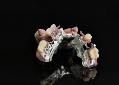 China Biocompatible Metal Framework Partial Dentures Crafted to Deliver Performance and Patient Satisfaction in Dental Practices for sale