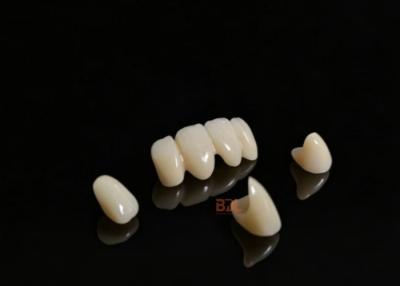 China Titanium Dental Implant Support Bar Durable Corrosion Resistant Precision Engineered for Secure Dental Prosthetics Applications for sale