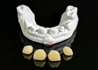 China Forbidden Access Status Ceramic Dental Prosthesis Offering Durable Solutions Suitable For Dental Laboratories And Clinics for sale