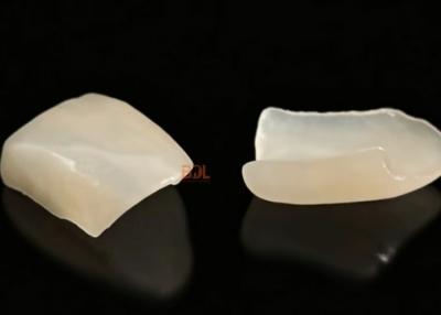 China High Strength Emax Ceramic Veneer with Natural Translucency and Color Stability Ensuring Long Term Patient Satisfaction for sale