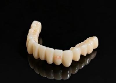 China Forbidden Access Status Verify Credentials Check Permissions Zirconia Dental Bridge Dental Restoration Durable Material for sale