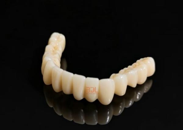 Quality Forbidden Access Status Verify Credentials Check Permissions Zirconia Dental Bridge Dental Restoration Durable Material for sale