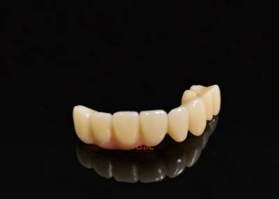 China Strong Durable Advanced Ceramic Denture Providing Excellent Biocompatibility and Aesthetic Value for Dental Professionals for sale