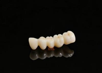 China Durable Ceramic Dental Prosthetics made from ceramics ensuring excellent strength natural appearance and long term for sale