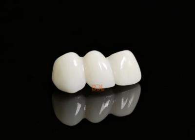 China Lightweight Ceramic Dental Prosthetics engineered for optimal comfort outstanding functionality and seamless integration for sale