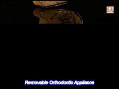 removable orthodontic appliance for easy to clean convenient removal with worry free correction
