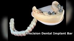 Malong Bridge Implant Bar Precision Dental Restoration