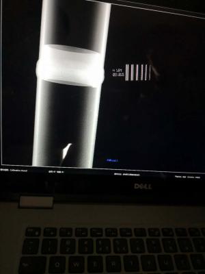 中国 ポータブル高周波X線欠陥探知機 販売のため