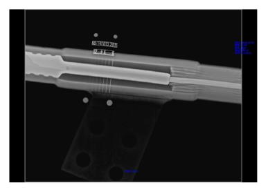 China DR System High Performance Industrial DR X-ray High-Definition Digital Plate Detector for sale