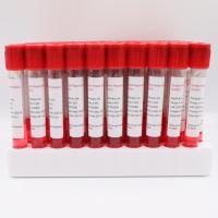 China 5ml Special Thread Sample Collection Tube Ethylene Oxide for sale