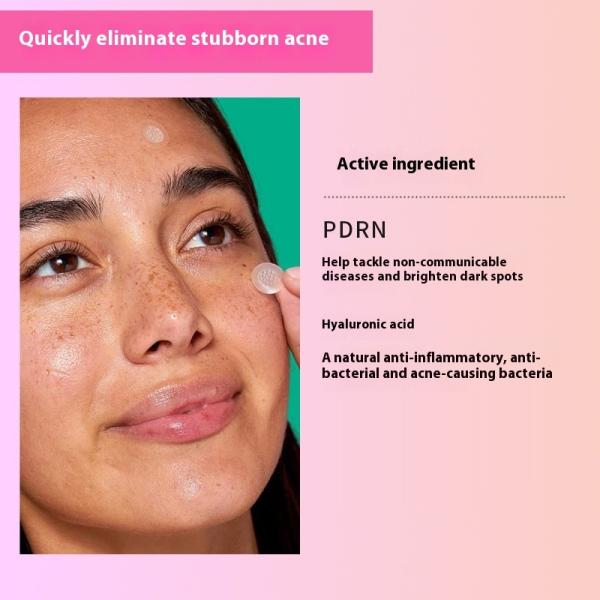 Quality Single Sided Painless Microneedle Acne Patch Microcrystals Water Activated PE for sale