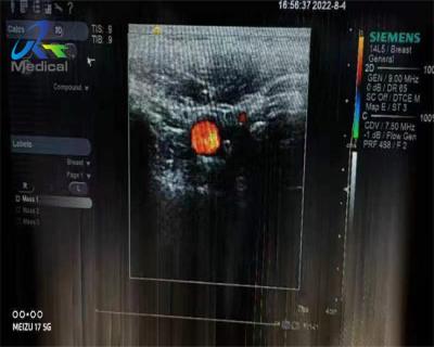Cina Manutenzione Crystal Array del trasduttore di ultrasuono di matrice lineare di Siemens 14L5 e sostituzione di abitazione in vendita