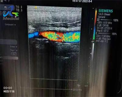 Cina Manutenzione Crystal Array del trasduttore di ultrasuono di matrice lineare di Siemens 14L5 e sostituzione di abitazione in vendita