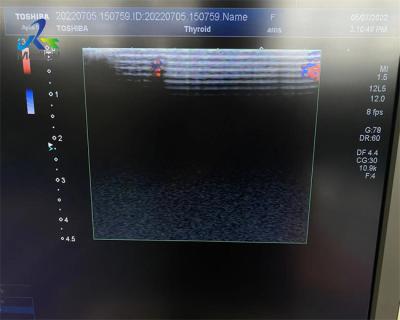 China Van de de Serieultrasone klank van Toshiba plt-805AT Lineair van de de Omvormersonde de Schakelaarhuisvesting en Crystal Array Replacement Te koop