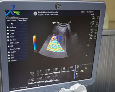 Cina La riparazione della macchina di ultrasuono di anomalia di immagine di GE Logiq S8 sostituisce il bordo di Manica in vendita