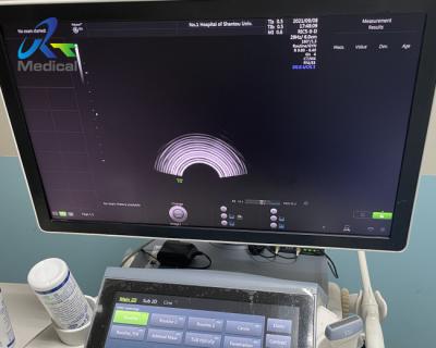 Cina Macchina di ultrasuono di GE Voluson E10 spenta per sostituire l'alimentazione elettrica in vendita