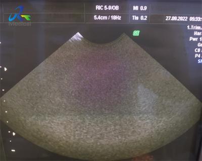 Китай Ремонт Кристл зонда ультразвука GE RIC5-9-D одевает замену кабеля купола 4D продается