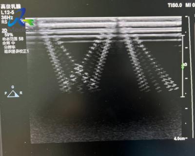 Cina La riparazione della macchina di ultrasuono di  EPIQ 5 tutte le immagini della sonda è anormale sostituisce ACQ in vendita