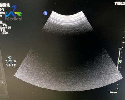 Cina La riparazione della macchina di ultrasuono di  EPIQ 5 tutte le immagini della sonda è anormale sostituisce ACQ in vendita
