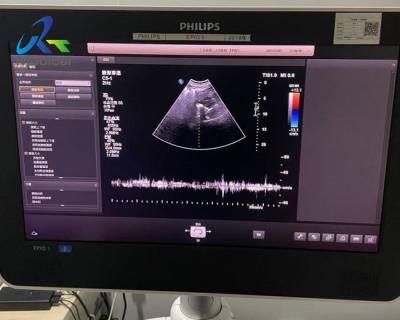 Cina EPIQ 5 Ultrasound Machine Repair Report Errore quando la sonda di commutazione sostituisce ACQ 453561184013 in vendita