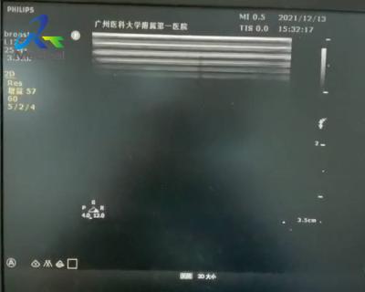 Cina Sparq Ultrasound Machine Repair Immagine anomala Sostituire Channel Board 453561184013 in vendita