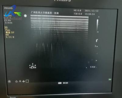 Cina Sparq Ultrasound Machine Repair Immagine anomala Sostituire Channel Board 453561184013 in vendita