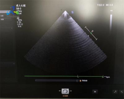 China Imagem de manutenção do transdutor da sonda de ultrassom GE S8-3 com erro à venda