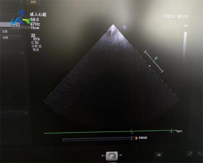 China Imagem de manutenção do transdutor da sonda de ultrassom GE S8-3 com erro à venda