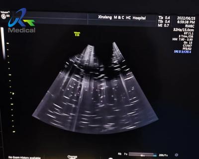 Cina Prova difettosa di immagine anormale di riparazione della macchina di ultrasuono di GE Voluson E10 in vendita
