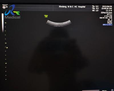 Cina Prova difettosa di immagine anormale di riparazione della macchina di ultrasuono di GE Voluson E10 in vendita