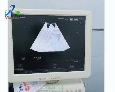 Cina Analizzatore luminoso della radiografia di interferenza di Manica di immagine di Avius di VISIONE di riparazione RXBF HI della macchina di ultrasuono di doppler in vendita