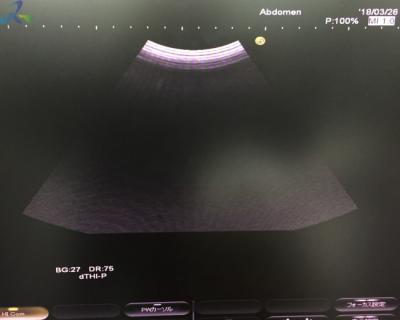 China Sonda de ultrassom abdominal Hitachi EUP-C715 Diagnóstico por imagem à venda