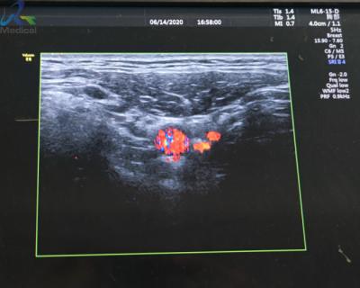 China Transdutor vascular linear GE Logiq E9 ML6-15-D para reparo de sonda de ultrassom de mama à venda