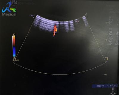 Cina Riparazione della sonda di ultrasuono di GE 4C-RS per la sostituzione Crystal Damage dell'alloggio di gommino di protezione di matrice in vendita