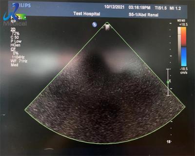 Cina S5-1 sostituisce riparazione di collegamento della sonda del cavo della lente la 2D in vendita