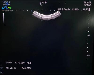Cina Apparecchio medico diagnostico di Hitachi Aloka Probe C251 della sostituzione della lente in vendita