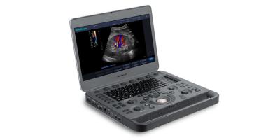 Cina Smart avvista la macchina di ultrasuono di SonoScape del computer portatile 500GB con 15,6» LCD in vendita