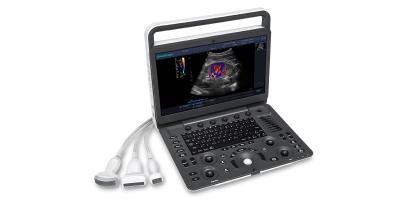 Cina Smart avvista la macchina di ultrasuono di SonoScape del computer portatile 500GB con 15,6» LCD in vendita