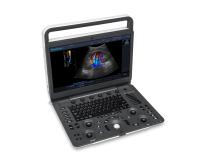 China Panoramic Imaging SonoScape E2 PRO Portable Ultrasound Machine for sale