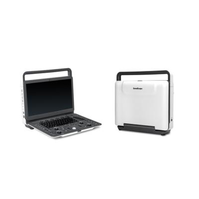 Cina ultrasuono di BW della macchina di ultrasuono di 15.6inch LED Sonoscape E1 Exp in vendita