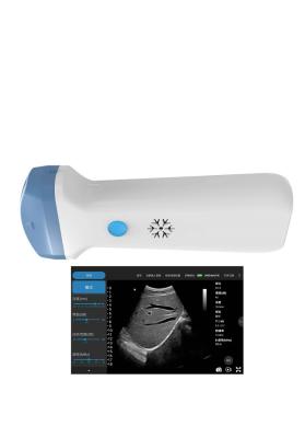 China Draadloze de Ultrasone klanksonde van anesthesieipad voor POCUS-Examens Primaire Zorg Te koop