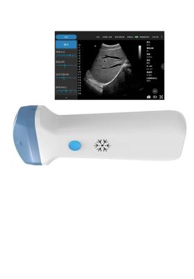 China Draadloze de Ultrasone klanksonde van anesthesieipad voor POCUS-Examens Primaire Zorg Te koop