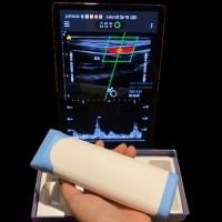 China High Performance Electronic Linear Array PICC Handheld Ultrasound Scanner for sale