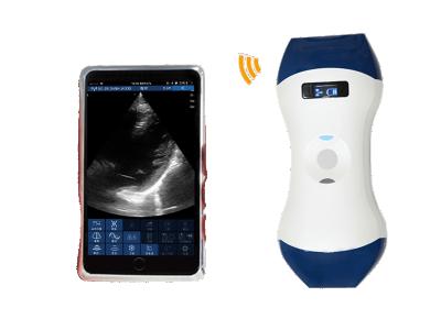 China FDA CE ISO13485 Palm Size Wireless Handheld Ultrasound Probe with Phased Array and Linear Dual Head for POCUS for sale
