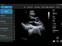 5MHz Pocket Handheld Ultrasound Scanner For Mobile Cardiac Diagnosis