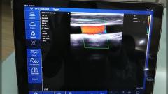 128 Element Dual Head Wireless Ultrasound Probe
