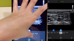 Golead linear ultrasound probe for basilic vein